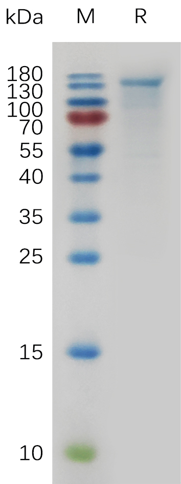 Mouse CEACAM5 Protein, His Tag - 专注肿瘤免疫