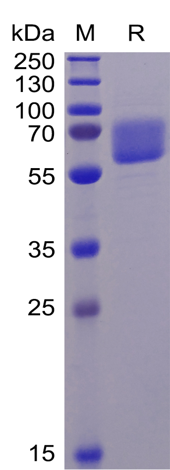Human AXL Protein, His Tag - 专注肿瘤免疫