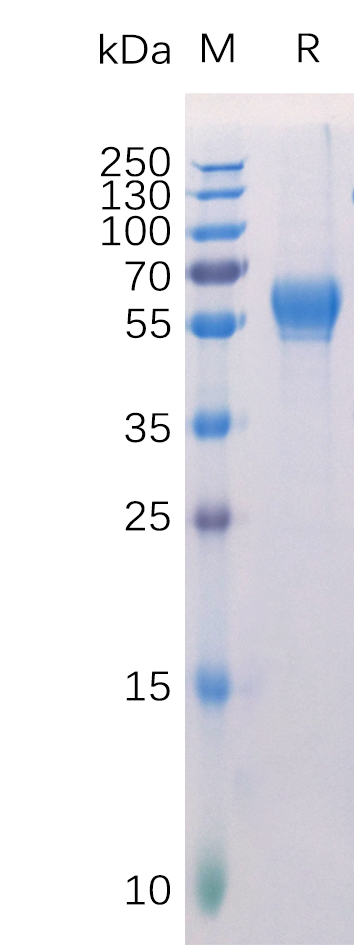 Human ROR1 Protein, His Tag - 专注肿瘤免疫