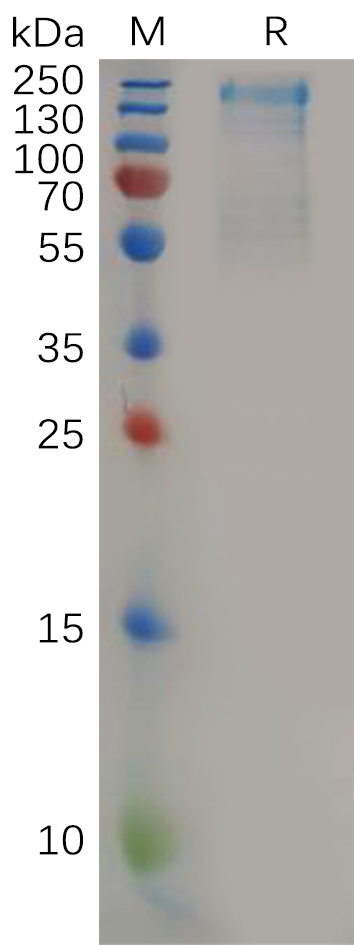 Human CD45 Protein, His Tag – 专注肿瘤免疫