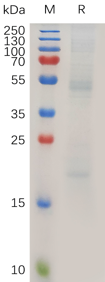 Human RAGE Protein, His Tag - 专注肿瘤免疫