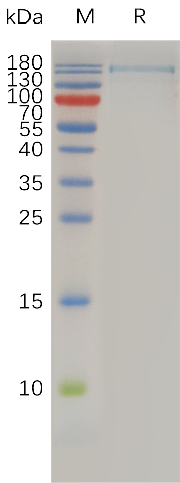 Human ITGAX and ITGB2 Heterodimer Protein, His Tag and hFc Tag - 专注肿瘤免疫