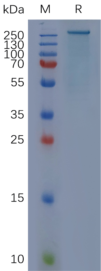 Human FN1 Protein, His Tag - 专注肿瘤免疫