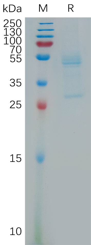 Human MSMP Protein, hFc Tag - 专注肿瘤免疫