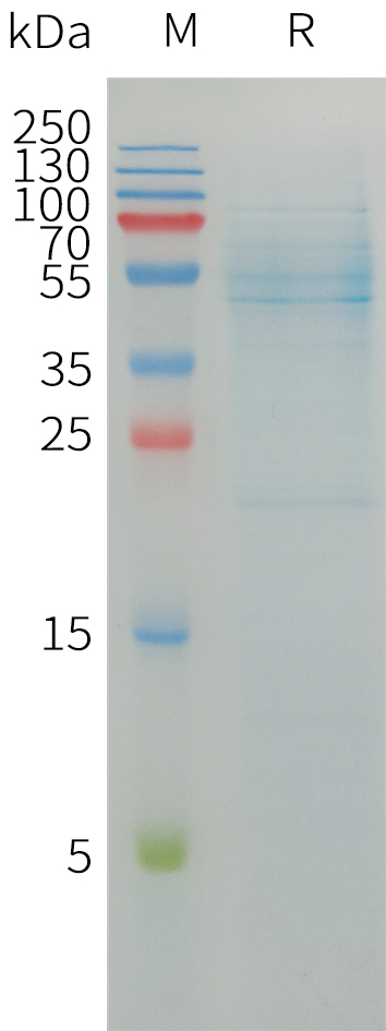 Human Selenop Protein, Flag Tag – 专注肿瘤免疫