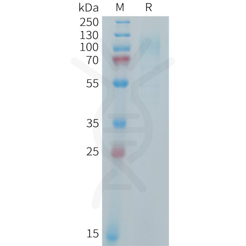 Human IL31RA Protein, His Tag - 专注肿瘤免疫