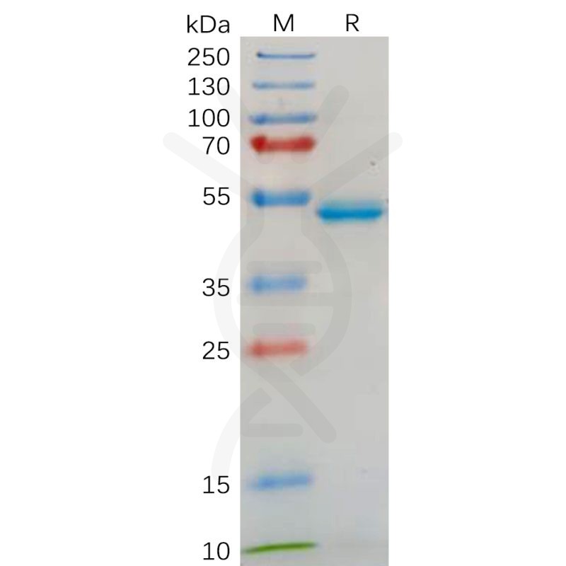 Human IL18 Protein, hFc Tag - 专注肿瘤免疫