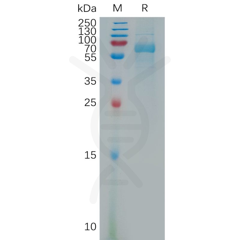 Human VPS4 Protein, His Tag-VPS4重组蛋白（C-6×His Tag）-缔码生物