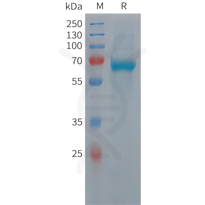 Human C9 Protein, His Tag-C9重组蛋白（C-6×His tag）-缔码生物
